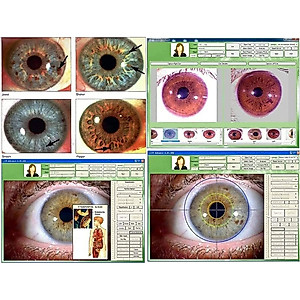 QXIUDDYS Iridology Camera Analyzer, Iris Analysis Camera, 5.0 MP USB Iris Analyzer Iridology Camera, Eye Iridology Camera, HD 30x Iris Lens and Driver-Free Analysis Software