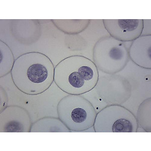 EISCO Ascaris & Onion Mitosis, Prepared Microscope Slide - 75 x 25mm - Plant & Animal Mitosis, Introductory Microscopy