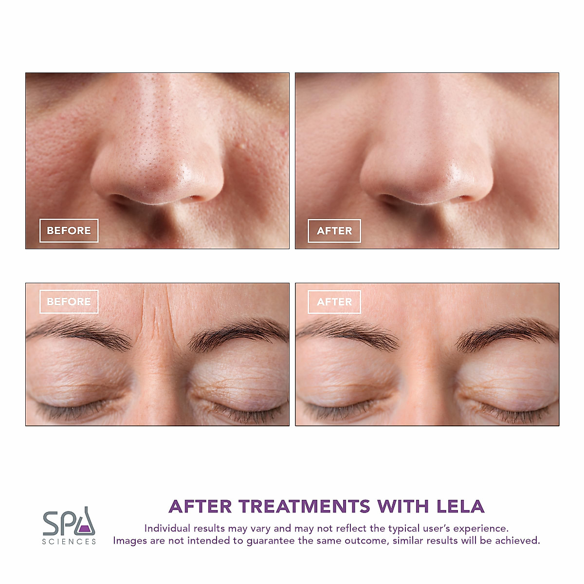 Spa Sciences - LELA - 4-in-1 Facial Spatula for Deep Cleansing, Pore Extraction, Serum Infusion, Anti-Aging and Contouring
