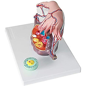DEAVER Medical Models, Uterine Anatomy Model Ovarian Enlargement Model Skin and Genitourinary System Anatomical Medical Training Aid