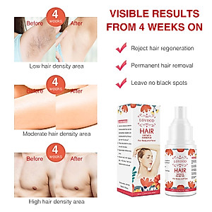 LOVOOD Hair Growth Inhibitor Spray - Non-Irritating & Painless for Face & Body, 1.01 Fl Oz (Pack of 1)