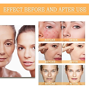 Glycolic Acid 7% Toning Resurfacing Solution