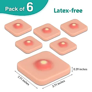 Ultrassist Abscess I&D Incision and Drainage Pad (6-Pack), Sebaceous Cyst Removal Trainer, Suture Practice Skin Pad for Medical Education
