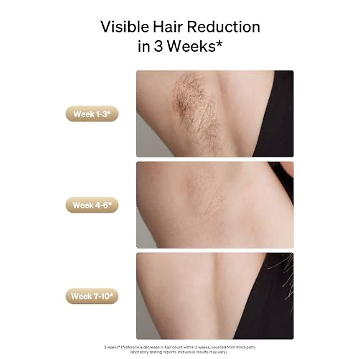 Ulike Laser Hair Removal for Women and Men, Air 3 Ice-Cooling IPL Hair Removal Device for Nearly Painless & Long-Lasting Results, 3 Modes & Auto Flashing for Fast Full Body Hair Removal from Home