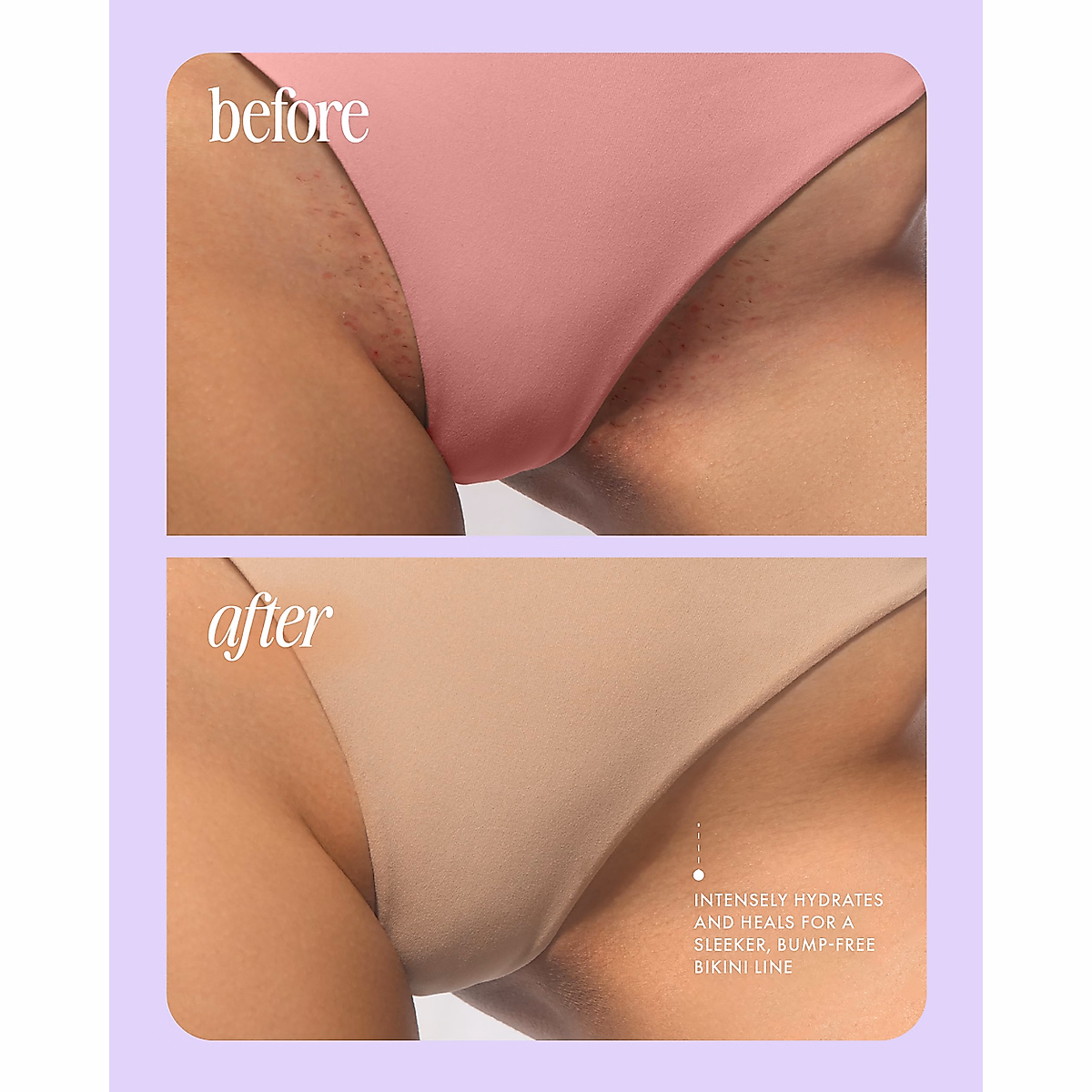 Truly Beauty Glazed Donut After Shave Oil - Razor Bumps Treatment for Women, Razor Bump and Ingrown Hair Treatment for Bikini Area - 3.1 OZ