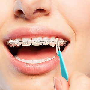 LOVEWEE Dental Elastic Rubber Bands Placers for Braces, 20 PCS Disposable Plastic Orthodontic Elastic Placers Multi-color