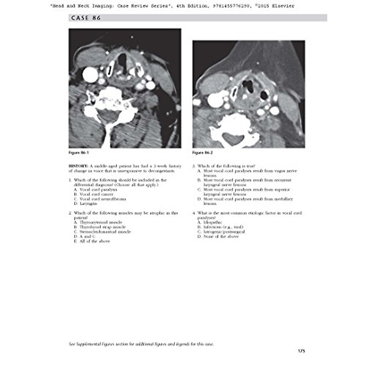 Head and Neck Imaging: Case Review Series