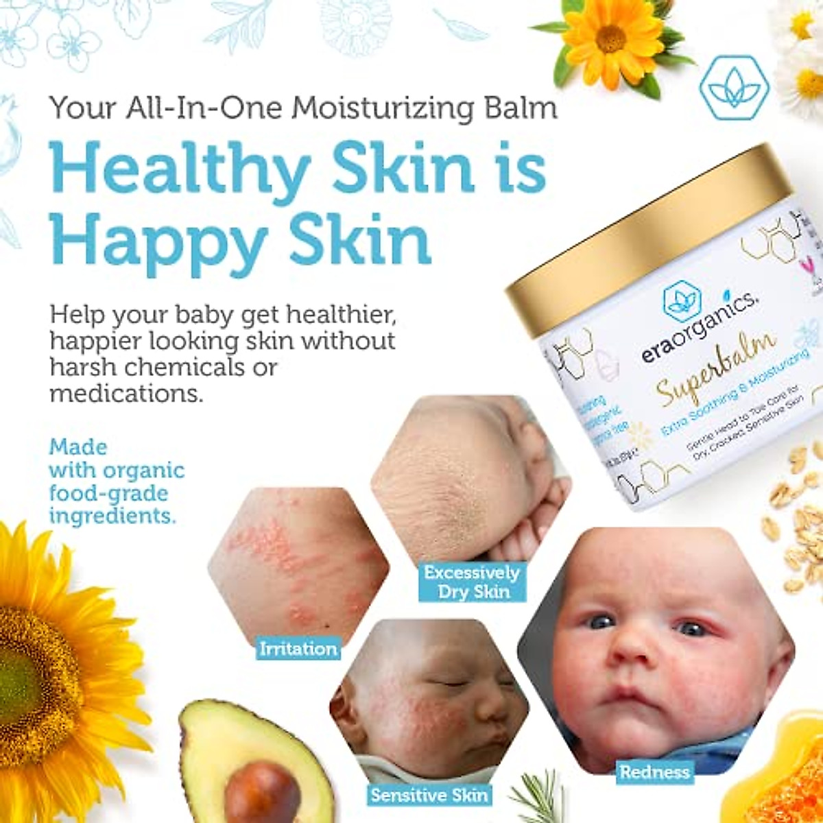 Era Organics Healing Ointment for Babies - USDA Certified Organic Natural Gentle Moisturizer for Sensitive Skin Prone To Baby Eczema, Cradle Cap (Infant Seborrheic Dermatitis), Rashes, Hives & More