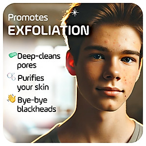 Asepxia Activated Charcoal Cleansing Bar for Enhanced Acne Control & Skin Purification with 2% Salicylic Acid, Ideal for Oily Skin and Reducing Blackheads - 4 Oz, 5-Pack