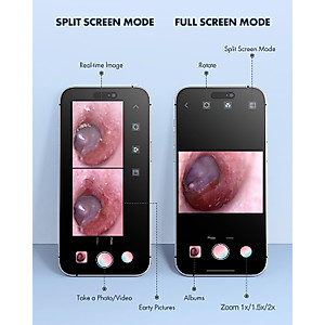 Anykit Ear Wax Removal Tool, Ultra Clear View Ear Scope with LED Lights for Ear Cleaning, Ear Cleaner Camera Otoscope with Ear Spoon & Specula for Phone & Tablet