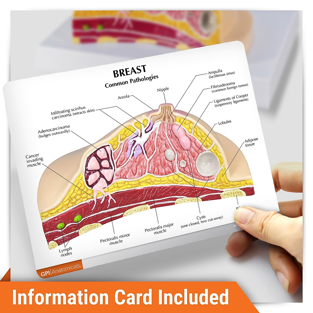 Breast Cross-Section Model | Human Body Anatomy Replica of Breast w/Common Pathologies for Doctors Office Educational Tool | GPI Anatomicals
