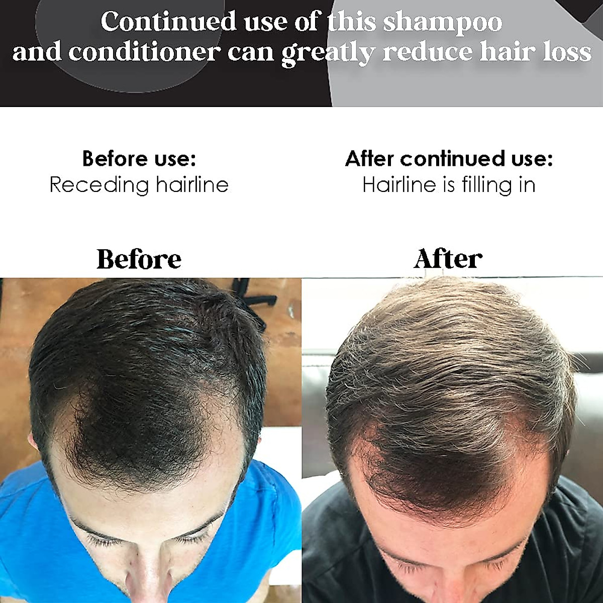 B THE PRODUCT High Potency Biotin Hair Growth Shampoo & Conditioner Set - Fortified with Vitamins E, A, C & B for Fastest Hair Growth (8.5oz.)