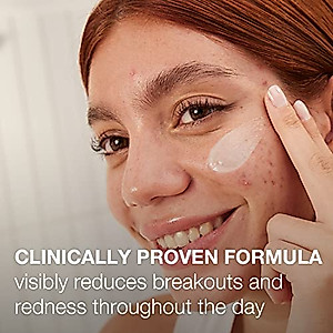 Neutrogena Stubborn Acne AM Face Treatment with 2.5% Micronized Benzoyl Peroxide Acne Medicine, Oil-Free Daily Facial Treatment to Reduce Size & Redness of Breakouts, Paraben-Free, 2 oz