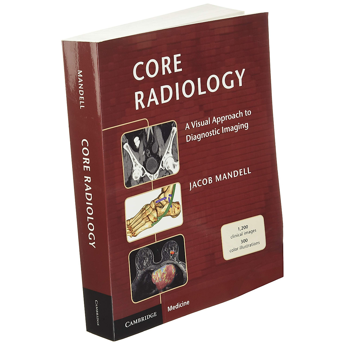Core Radiology: A Visual Approach to Diagnostic Imaging