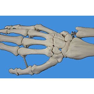 Wellden Product Anatomical Human Right Hand with Ulna and Radius Skeleton Model, Life Size