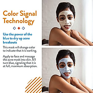 Acne Free Clearing Sulfur Mask Absorbs Excess Oil & Unclogs Pores with Vitamin C and Bentonite Clay, 1.7 Oz