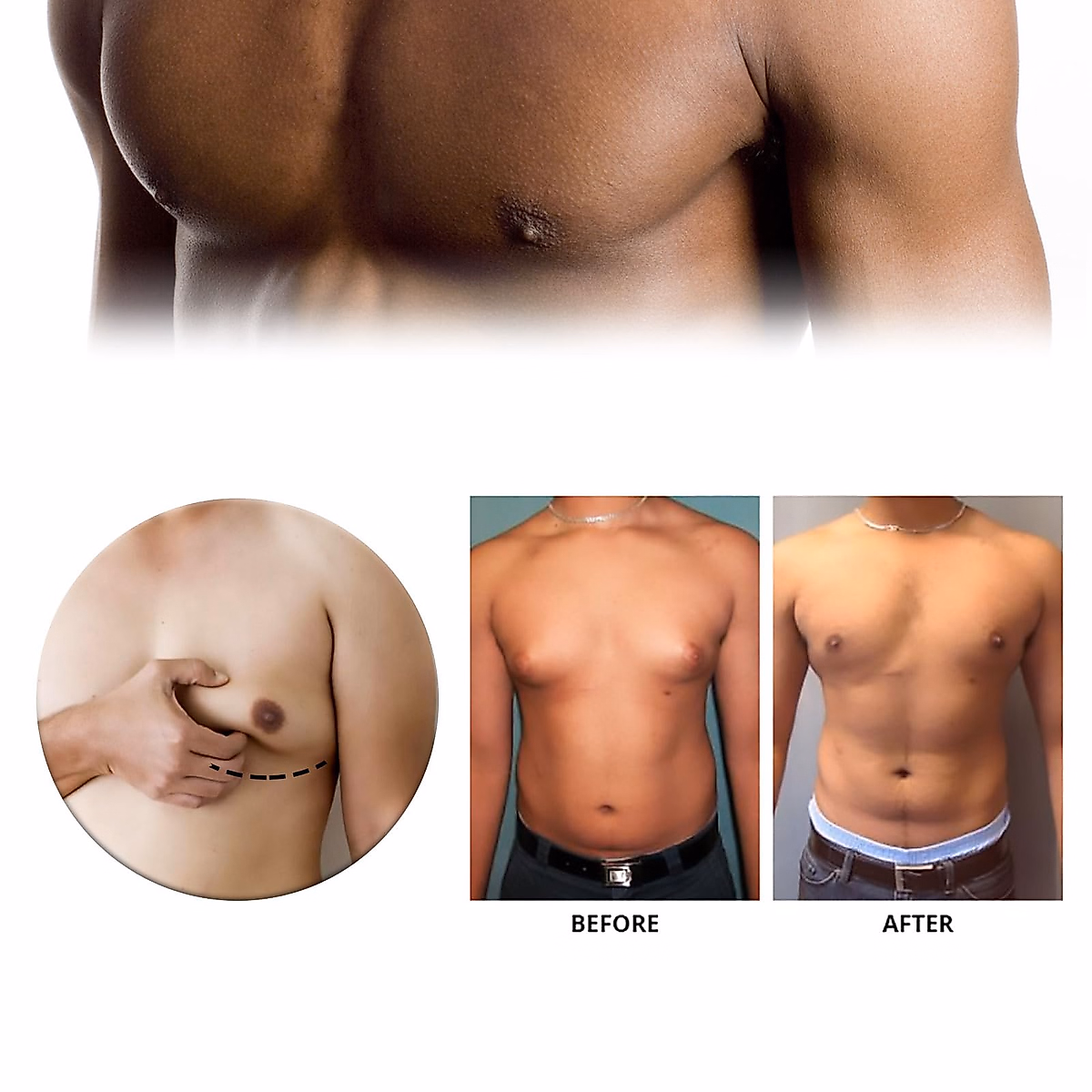 MQSHUHENMY SoliPac Gynecomastia Tightening Ginger Cream, Ginger Cream for Adults, Skin Tightening Cream, Tummy Tightening Cream (3Pcs)