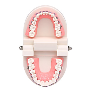 Angzhili 1 Piece Dental Demonstration Orthodontic Model with Metal Wires and Bracket (Metal bracket)