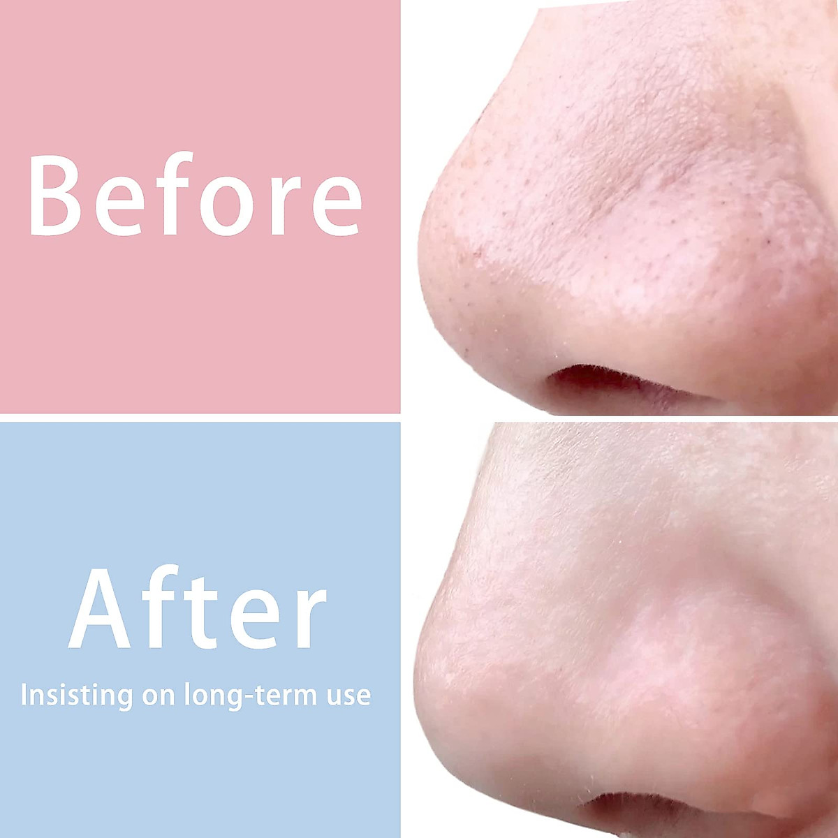 MIG4U Mini 3 PCS Exfoliating Facial Scrubber Mitt, Face Cleanser Wash Mittens Exfoliator for Men & Women Dead Dry Skin SPA, Blackhead Cleansing Gloves