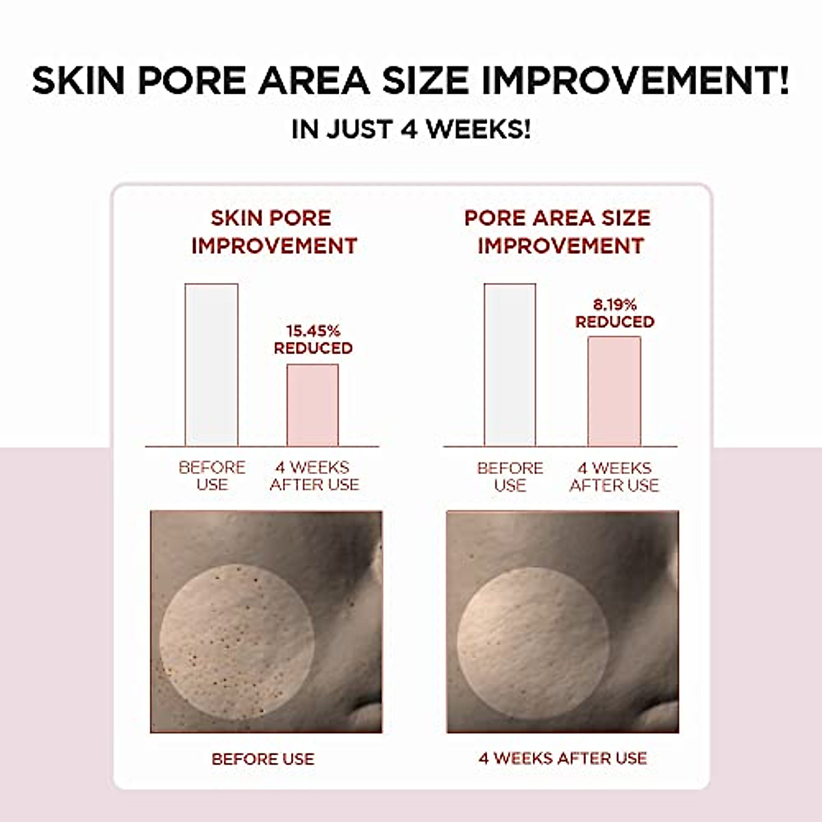 SKIN1004 Madagascar Centella Poremizing Clear Toner 7.1 fl.oz(210ml) | for Keratin Plug | for Sensitive Skin