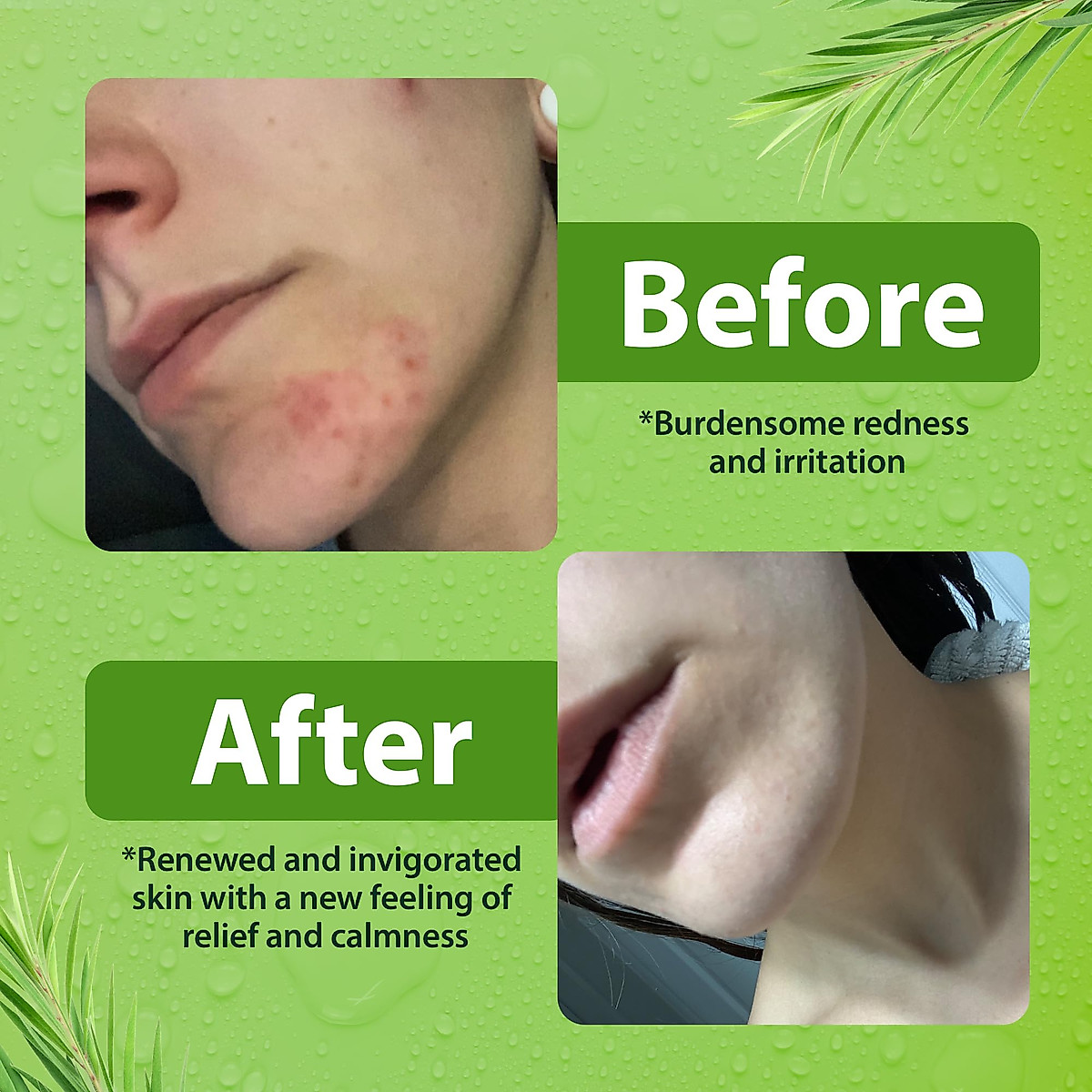 Antibacterial Body Wash for Healthy Skin Relief