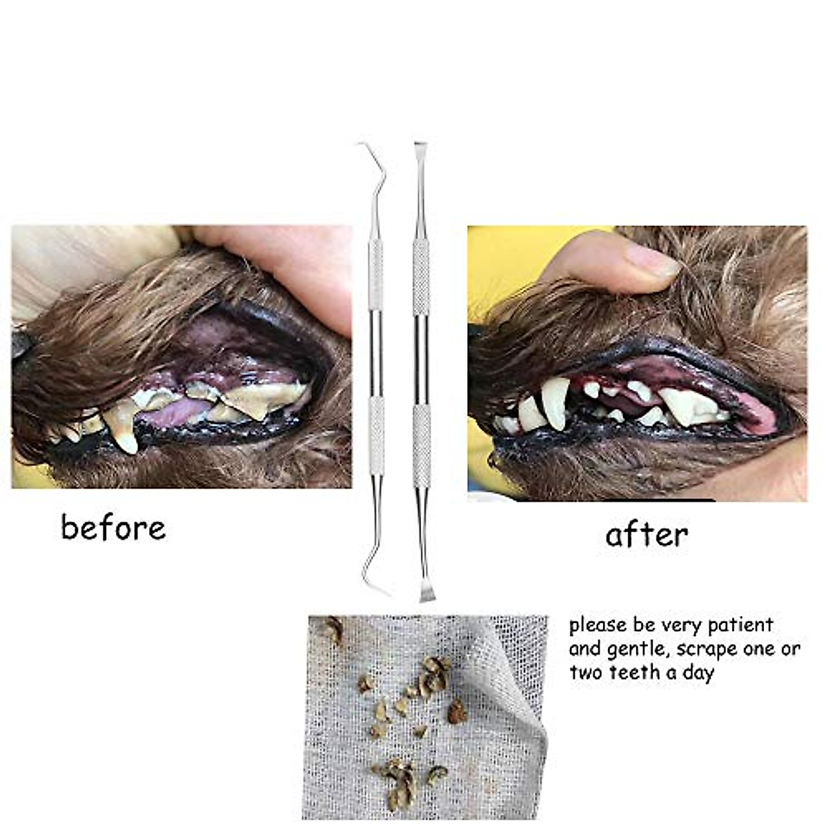 wzhe Dog Tooth Scaler and Scraper - 2 Pack Upgrade Pet Tarter Remover with Different Angles Double Head, Stainless Steel Teeth Cleaning Tools for Dogs