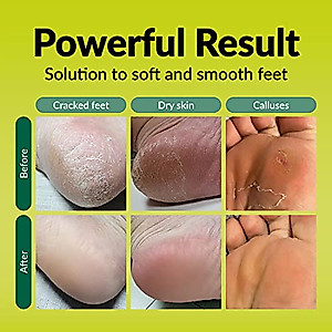 FARMSKIN Foot Peel Mask Clearing / Removes Dry Dead Skin for Cracked Feet / foot mask for soft baby feet with Tea Tree, Cica / Dermatologically Tested (Pack of 3)