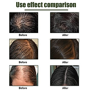 DUBUSH Grapefruit Essential Oil Hair Growth Spray,Follicle Nourishing Hair Growth Serum,Anti Hair Loss Hair Growth Oil,Hair Regrowth Spray for Thicker Hair