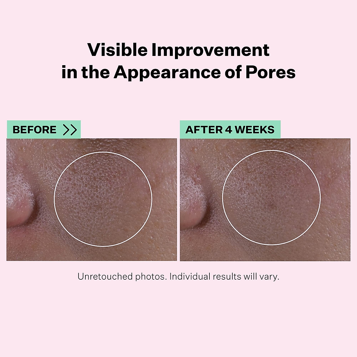 StriVectin Multi-Action Super Shrink Pore Minimizing Serum for minimizing clogged pores and blackheads for tightening and brightening skin texture