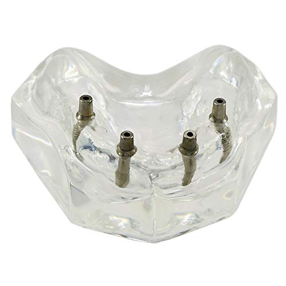 DENTALMALL Dental Upper Implants Model Overdenture with 4 Superior Teeth Demo Transparent Vision for Education and Study Model Tool M6001 C
