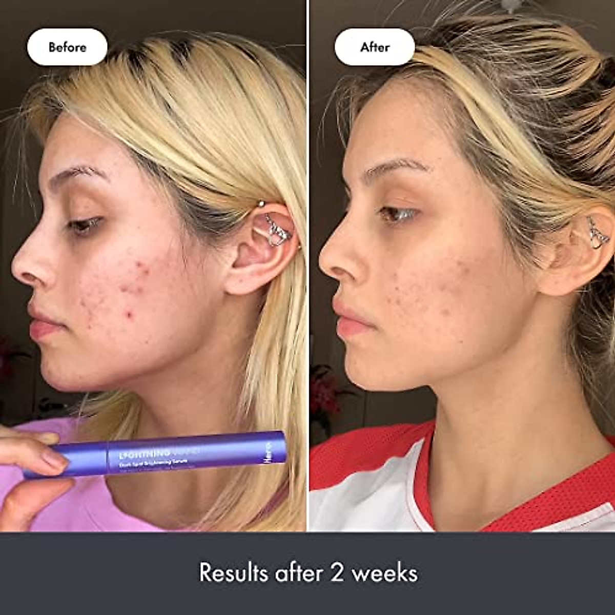 Lightning Wand from Hero Cosmetics - Brightening Serum for Fading Post-Blemish Dark Spots with Botanicals, Fragrance and Paraben Free (10 ml, 0.34 fl oz)