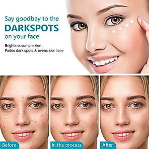 Dark Spot Remover For Face, Dark Spot Corrector and Remover, Sun Spots Melasma Freckle Remover, Packed with vitamins and natural extracts to treat dark spots, age spots, or sunspots (A)