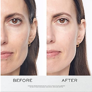 Lancôme Rénergie H.C.F. Triple Serum - Hyaluronic Acid Serum for Visible Correction of Anti Aging Signs - With Vitamin C+, Niacinamide & Ferulic Acid 1.7 Fl Oz