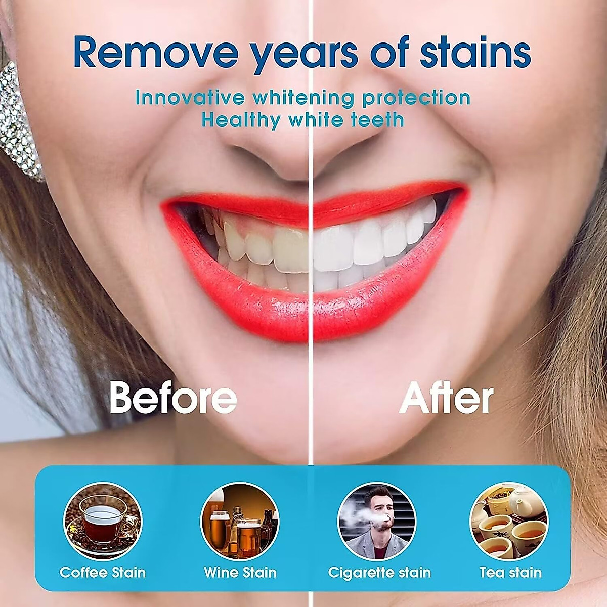 N Noble One Teeth Whitening Device with LED Red Lights Therapy, 32 LED Teeth Whitening Light, Enhancer Light Trays, 16 Minute Timer (White)