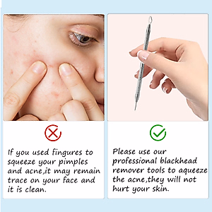 2-in-1 Facial Milia Removal and Whitehead Extractor & Lancet Circle Loop & Sharp Needle Pimple Popper Tool for Nose Face, Blemish Blackhead Extraction Pimple Acne (2pcs)