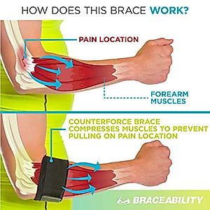 Counterforce Brace - Tendonitis Strap Support Band for Tennis & Golfers Elbow Pain