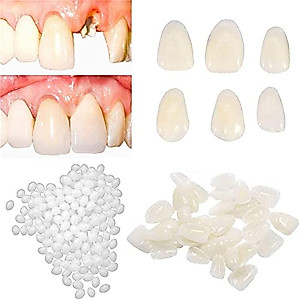 Cleaning Solution Temporary Tooth Kit For Filling The Missing Broken Tooth And Gaps Moldable Temporary Crown Veneers Material Anterior Front Back Molar Teeth Temporary Tooth Filler