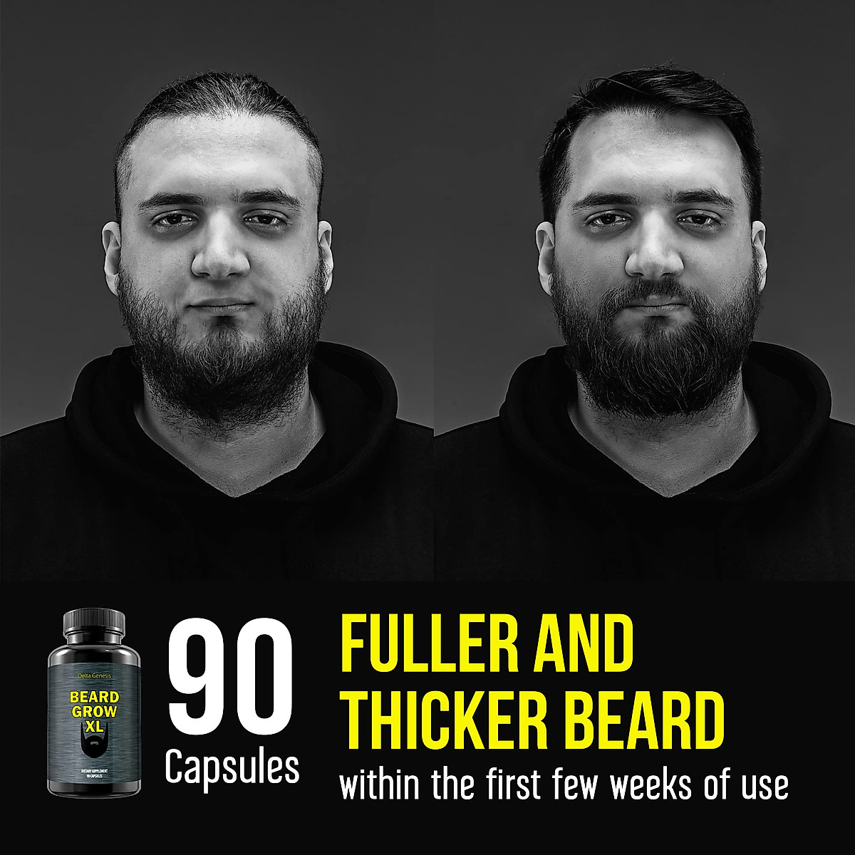 Beard Grow XL - Vegan Hair Growth Supplement for a Faster, Thicker, Fuller Beard - Enhances Your Grooming Kit