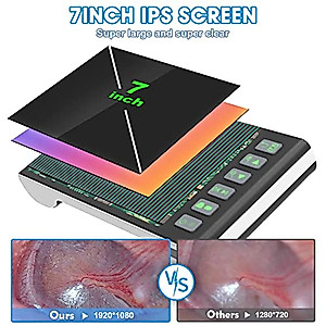 Digital Otoscope with 7.0 Inch Screen, Hiacinto 3.9mm Ear Camera with 6 LED Lights, 32GB Card, 3000 mAh Rechargeable Battery, 10Pcs Disposable Specula, 12 Ear Spoons