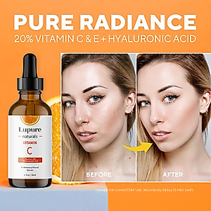 Lupure Professional Vitamin C Face Serum 20%, Anti Aging Facial Super Vit C Serum with Hyaluronic Acid & Vitamin E for Dark Spots, Skin Care, Christmas Gift & Stocking Stuffers | 1 Fl. Oz