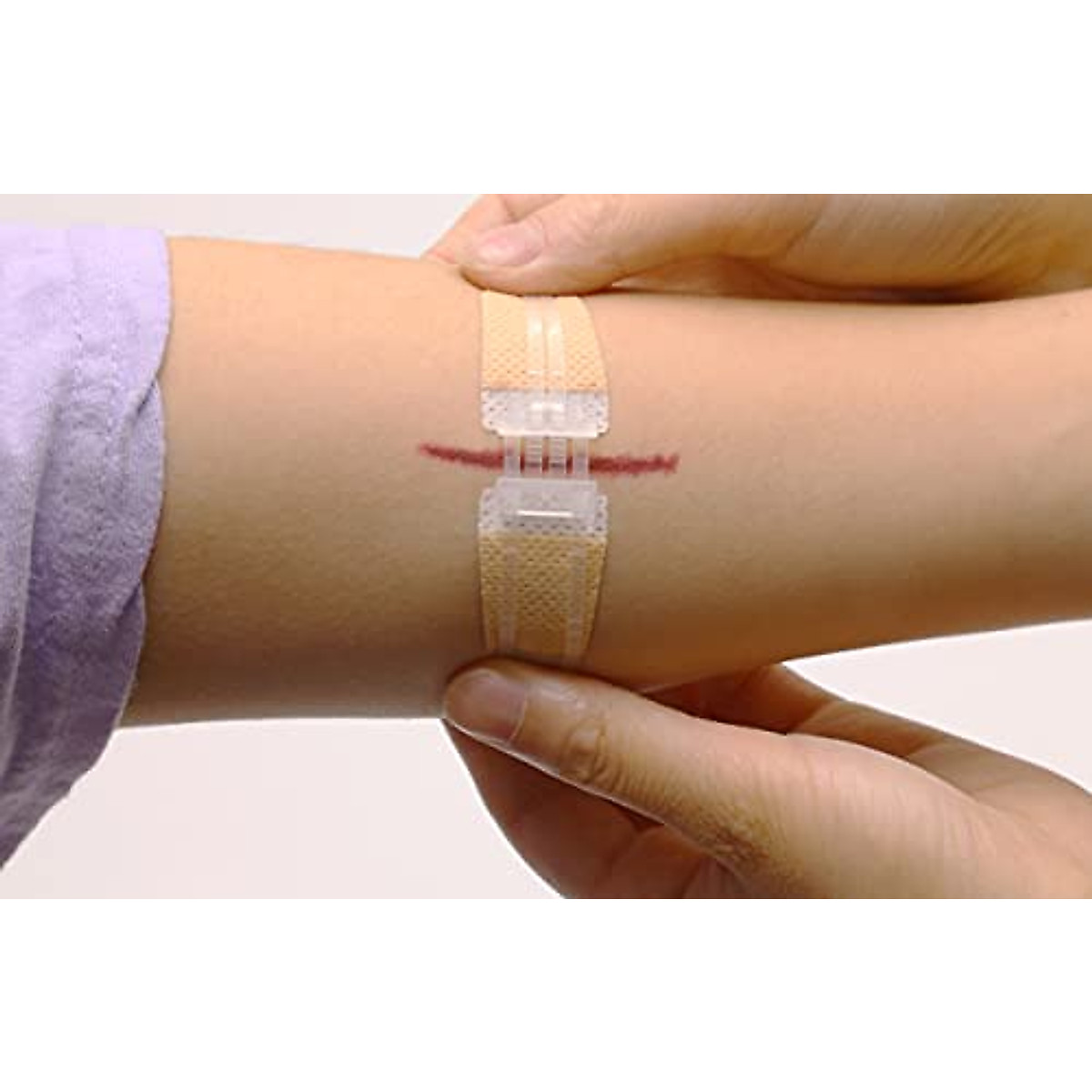 Israeli First Aid Emergency Laceration Closure Kit for Lacerations and Cuts, 10 Piece Set