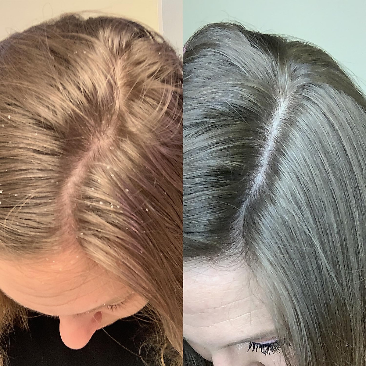 L'ANZA Healing Remedy Scalp Balancing Leave-in Treatment, Restores, Revives, and Nourish Hair & Scalp, Promotes Healthier Hair Growth, Thickness and Density (3.4 Fl Oz)