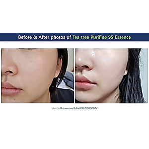 Dr.Ceuracle Tea Tree Purifine EssenceㅣThe Mildest Serum with 95% Tea Tree Extract ㅣLightweight Moisturizer for Returning Skin's Natural Vitality, ComplexionㅣIntensive Care for Calming Skin Trouble, Acne