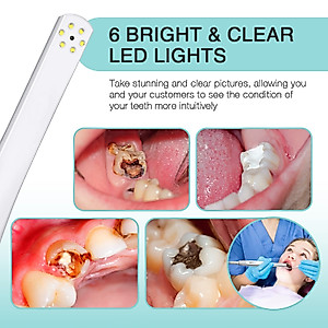 ProDENT Intraoral Camera PD740, Capture Button Driver to Work with Eaglesoft, Dexis, Apeteryx, Carestream, Tigerview,