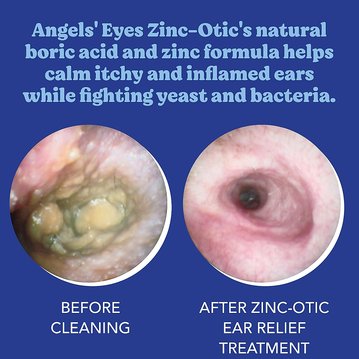 ANGELS’ EYES Zinc-Otic Ear Relief Treatment for Dogs and Cats Soothe Ear Infections Calm Itchy Inflamed Ears Natural BA and Zinc Formula 1 Ounce
