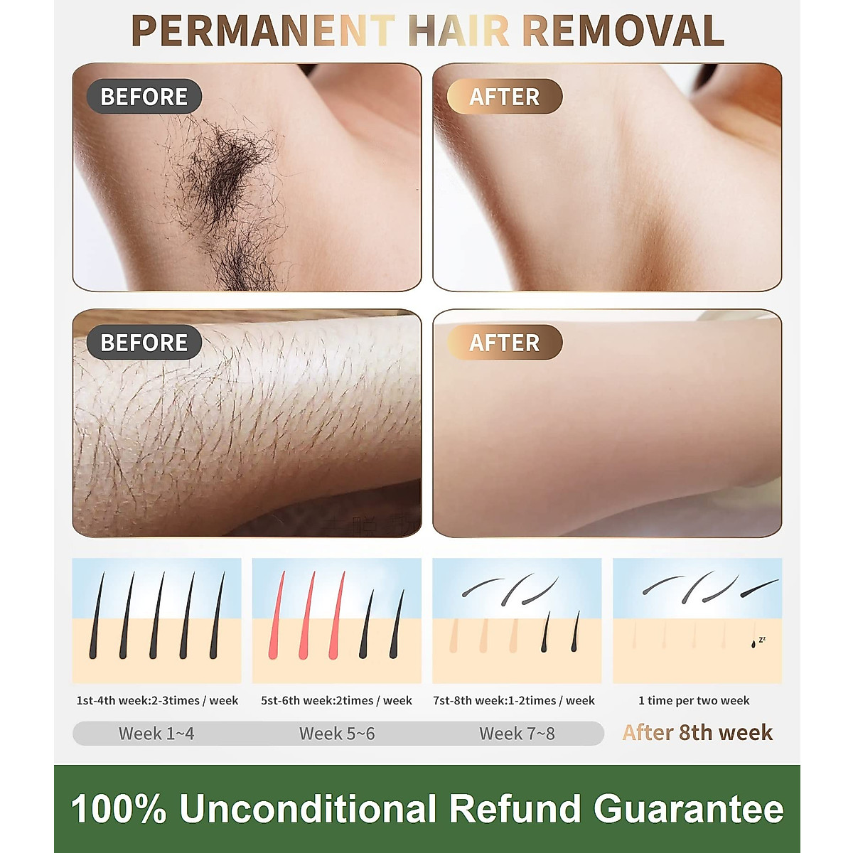 IPL Laser Permanent Hair Removal Device for Women and Men, Painless Best Hair Remover Whole Body Facial Armpits Back Legs Arms Face Bikini Line, 999,999 Flashes, Corded at-Home