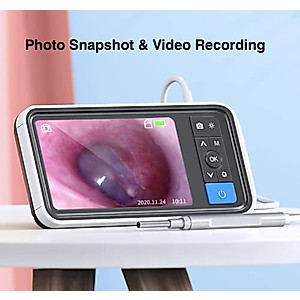 Digital Otoscope with 4.5" Screen & 3.9mm Ear Camera & 32GB Card, 6 Adjustable LEDs, 2500mAh Rechargeable Battery, IP67 Waterproof, Ear Wax Removal Tool, Supports Photo Snap and Video Recording