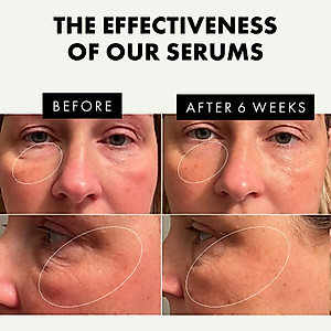 Eclat Skincare 3-Pack Face Serums - Vitamin C, Hyaluronic Acid, Retinol for Anti-Aging, Hydrating Care