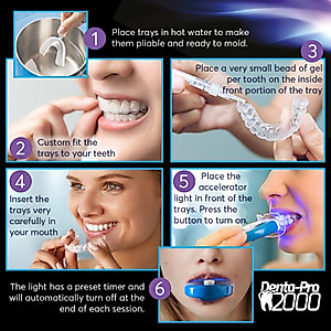 At Home Deluxe 3D Teeth Whitening Premium Kit By DentaPro2000 - If you Want Immediate Results This Is The kit To Use!