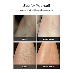 Ulike Laser Hair Removal for Women and Men, Air 3 IPL Hair Removal with Sapphire Ice-Cooling System for Painless & Long-Lasting Result, Flat-Head Design for Body & Face Treatment at-Home, Pink